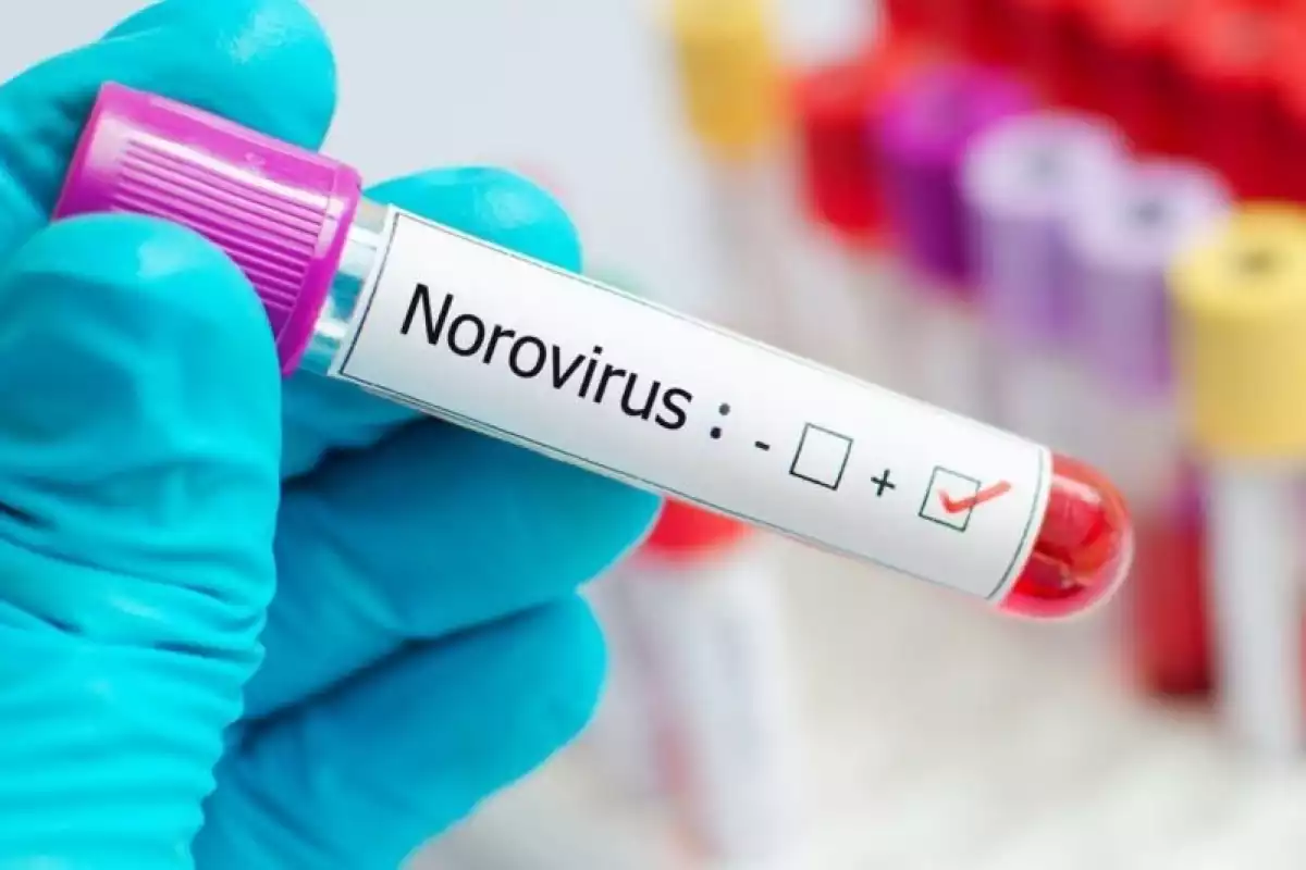 Norovirus: ¿Qué es y cuáles son sus síntomas? - PorEsto