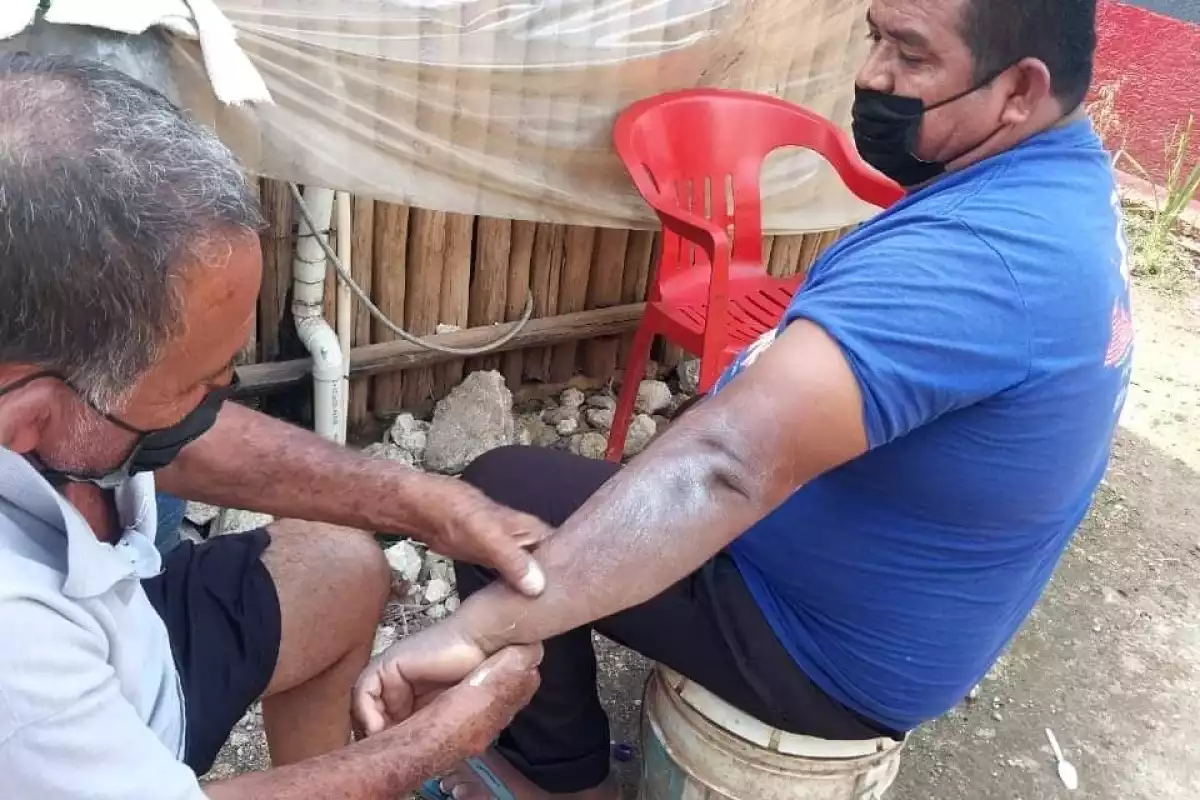 Historia de “Don Mulish”, uno de los pocos sobadores que hay en Lázaro ...