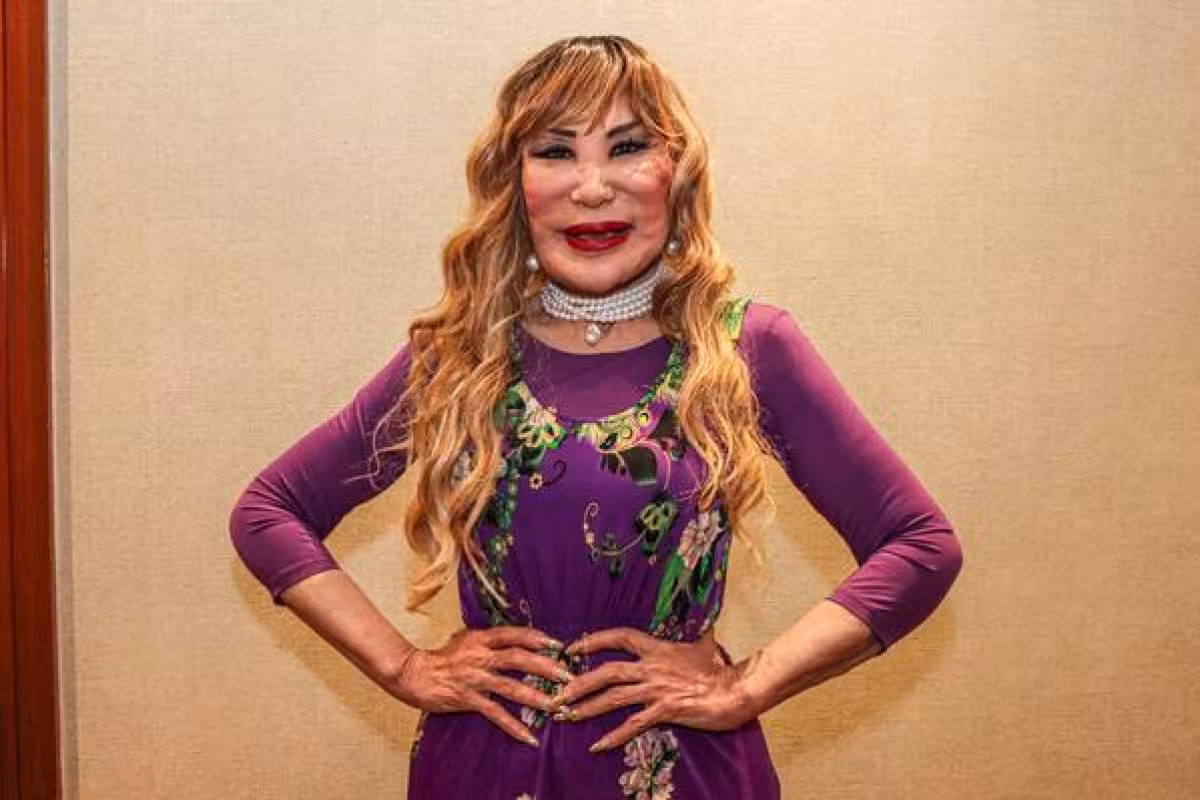 Lyn May asegura que se hará nueva cirugía en el rostro y sorprende a internautas - PorEsto