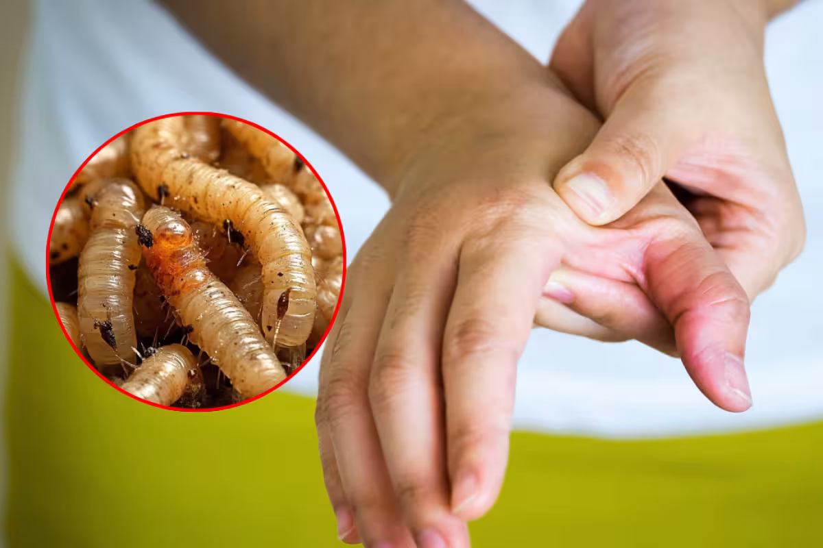 Gusano barrenador en humanos: Cómo afecta y cuál es la situación actual ...